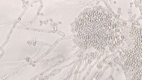 The Link Between Candida & Cancer | Templeton Wellness